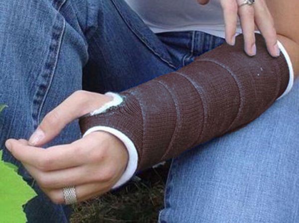 Cast / Ortho Supplies - A-1 Medical Integration
