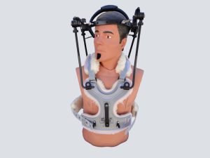 Halo Brace 1 - A-1 Medical Integration