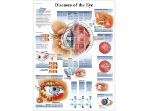 Anatomical Chart - Diseases of the Eye - A-1 Medical Integration