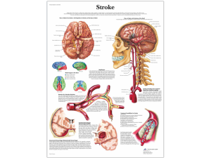 Anatomical Chart - Stroke - A-1 Medical Integration